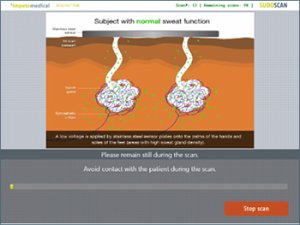 SUDOSCAN | A&B Equipos Médicos